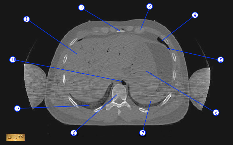Thorax Cross Section
