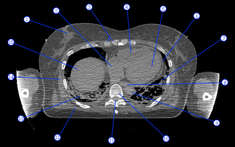 Thorax Cross Section