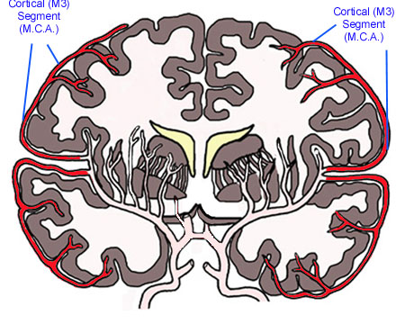Cortical Segment (M3) - Middle Cerebral Artery