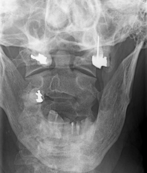 Try to identify the following