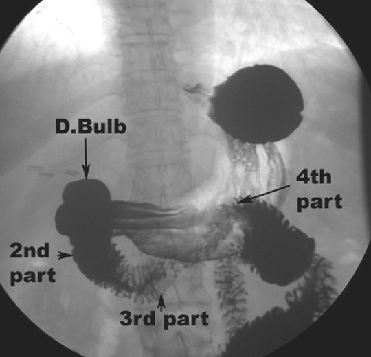 Course of Esophagus