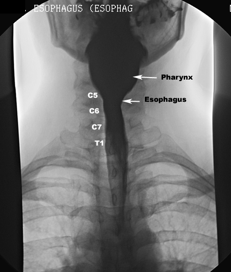Course of Esophagus