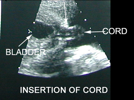 Mammography objectives