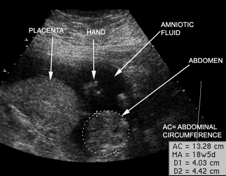 Mammography objectives